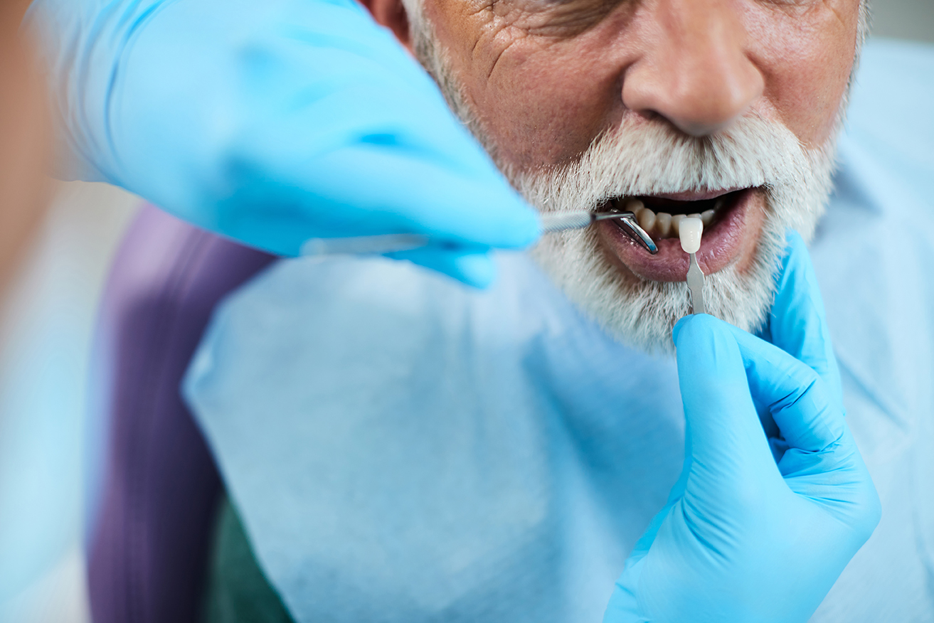 Full Mouth Reconstruction in Col - Medellin Restorative Dentistry